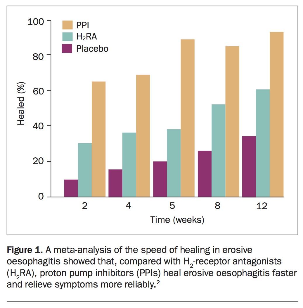 The risks and benefits of PPIs. Are they safe? | Medicine Today