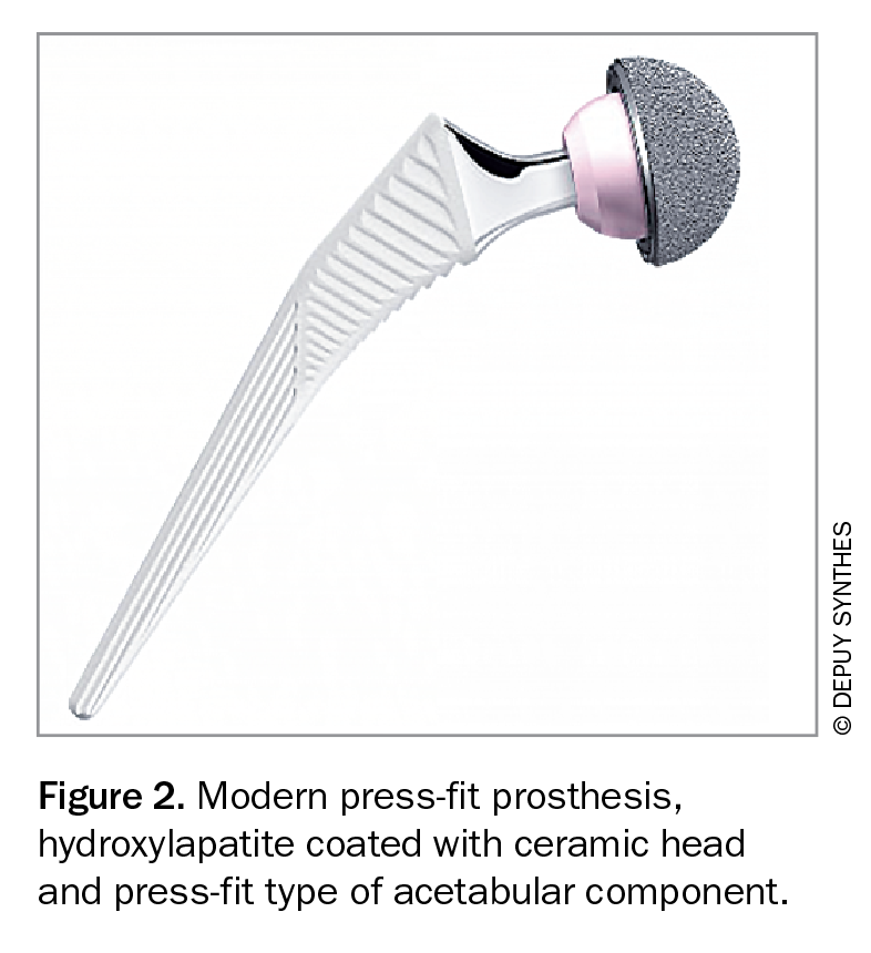 Hip replacements: what the GP needs to know | Medicine Today