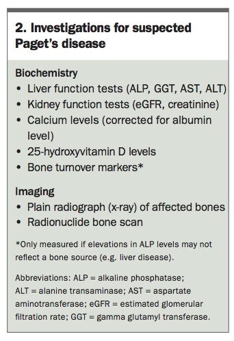 Paget’s disease of bone: who to treat and why it matters ...